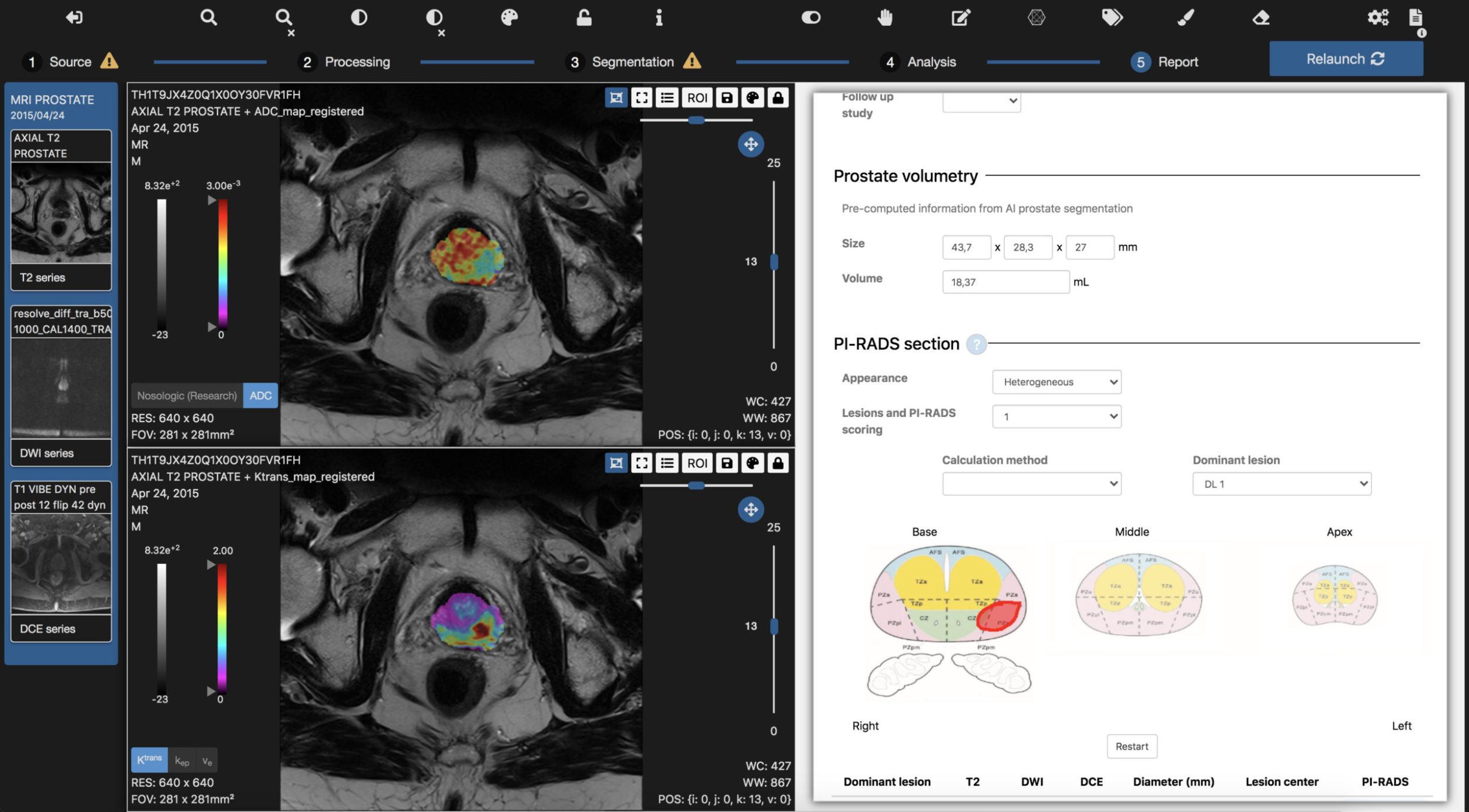 Prostate cancer detection and diagnosis: harnessing image data to do it ...