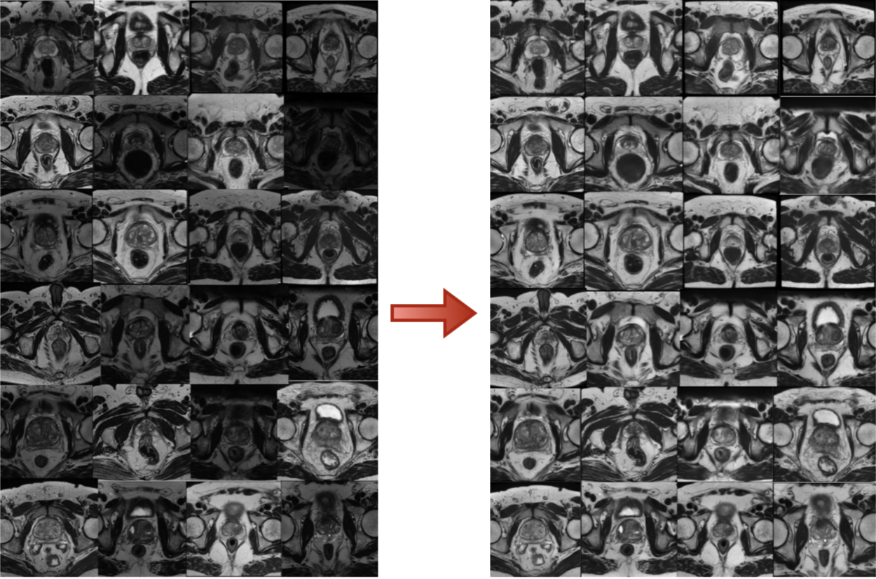 Understanding MRI image harmonization - Quibim Website