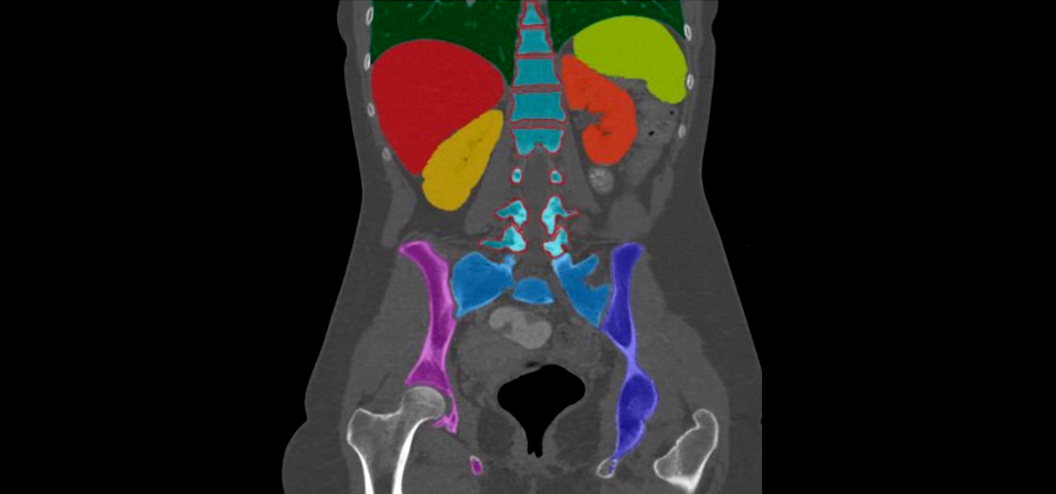 Accurate Segmentations In Ai Driven Solutions For Medical Imaging
