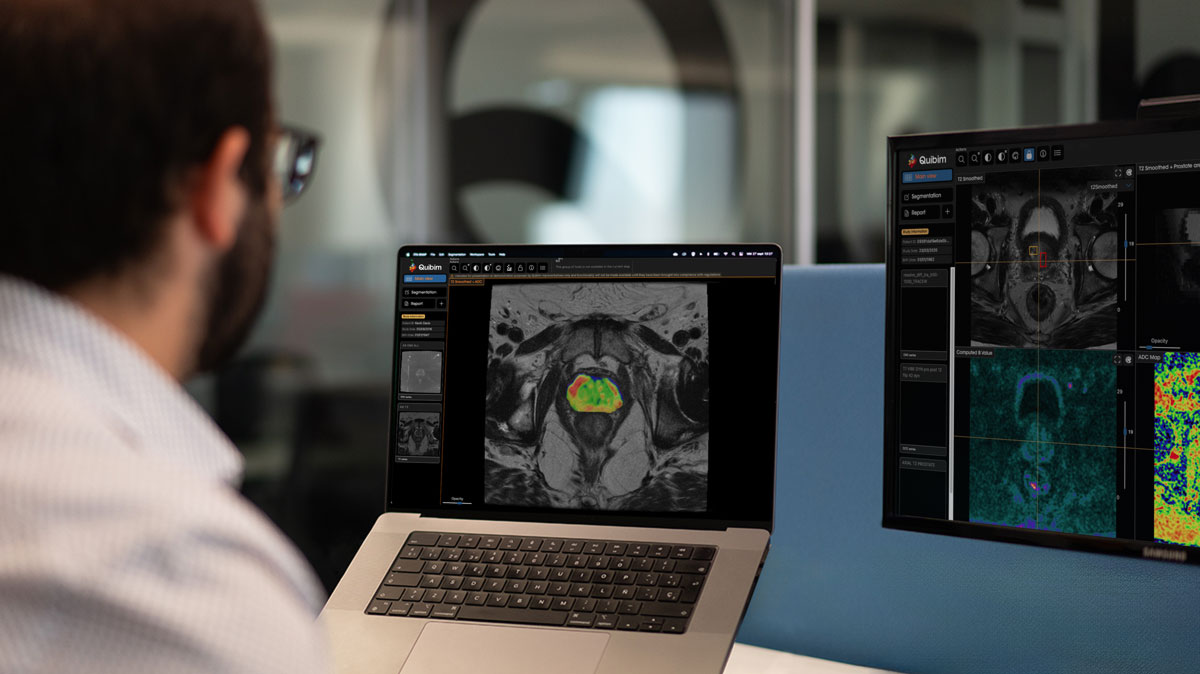 MRI Detection of Prostate Cancer - Quibim