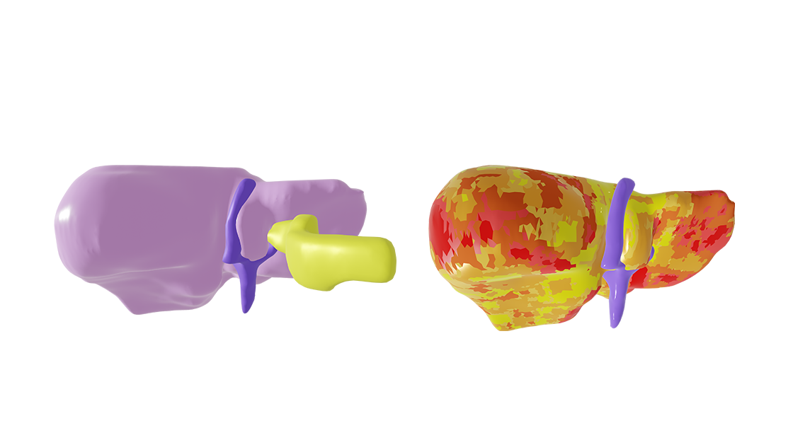 AI models for automated liver segmentation | QP-Liver