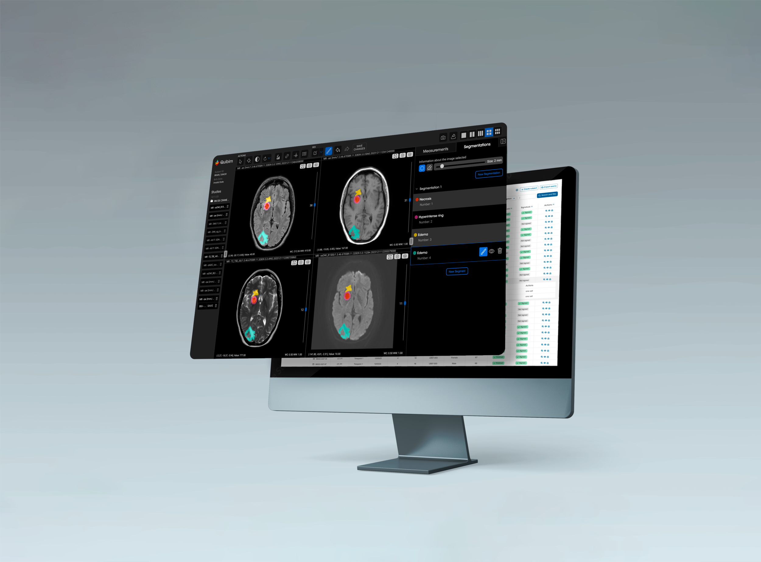 Your platform for managing and analizing imaging data - QP-Insights®