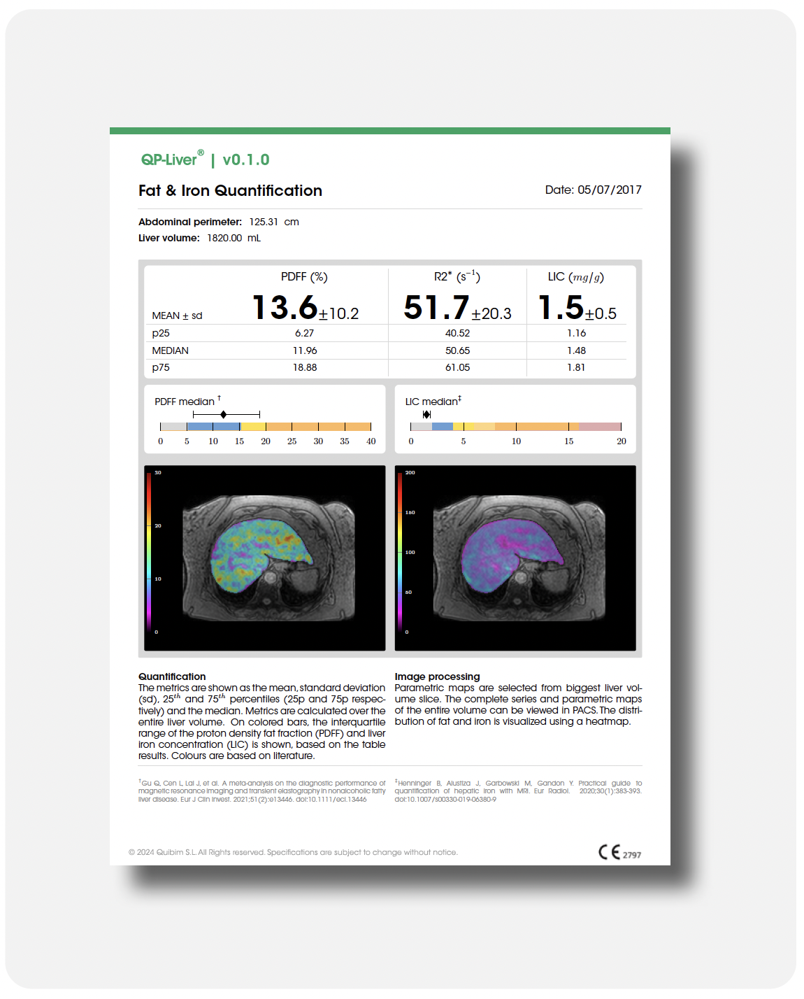 Personalized Liver Segmentation Based On Ai Qp Liver®