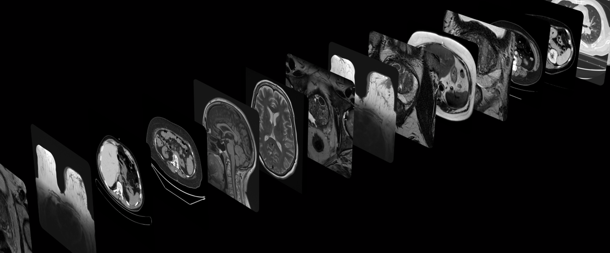 Oncology - Quibim Website
